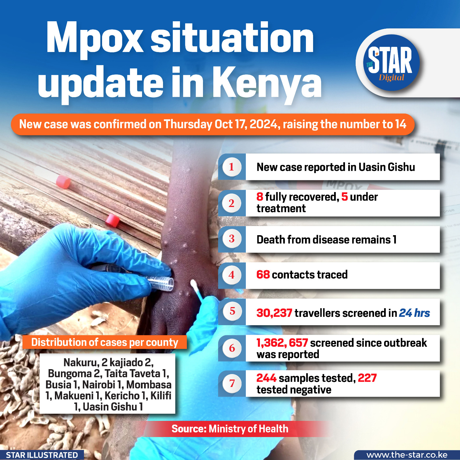Mpox situation update in Kenya